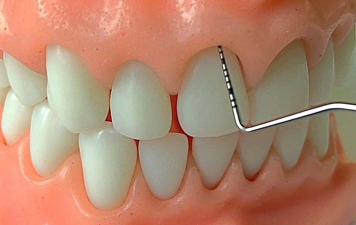 The Timing of Periodontal Exams: When Should You Schedule